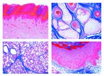Histology: Skin, 10 microscope slides | PHYWE